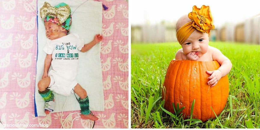 Your Story: Azlyn Lucille {a mini miracle} | Gracious May